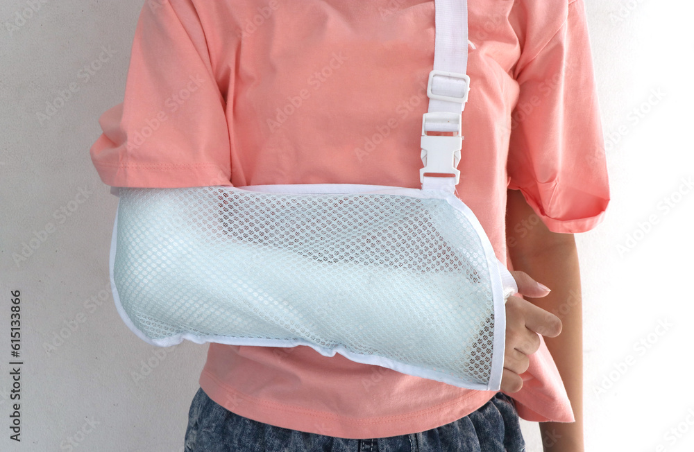 Teenage broken arm accident, treatment splint from doctor Stock Photo ...