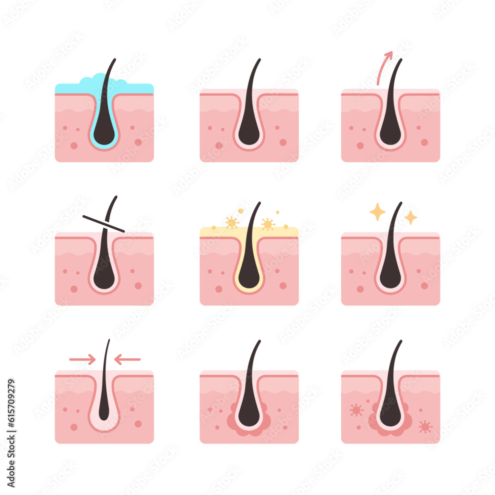 Vector collection of hair, hair loss, skin, pores, skin care ...