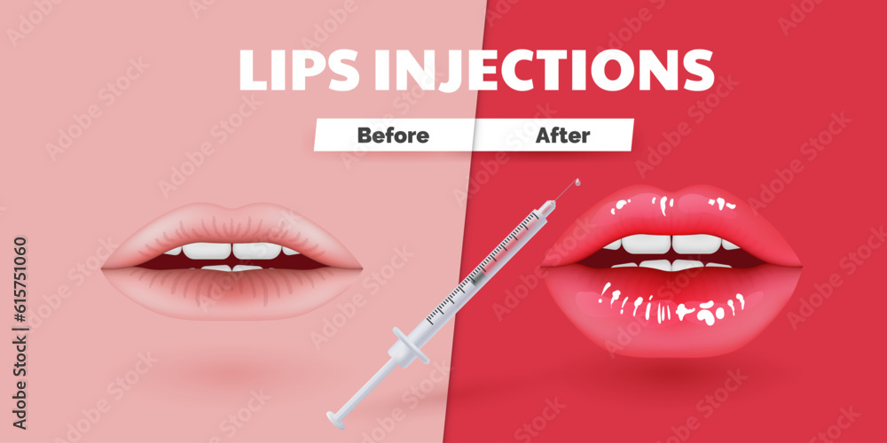 Before and after 3D vector illustration showcasing realistic lip ...
