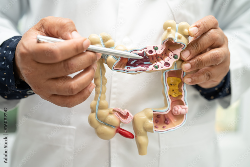Intestine, appendix and digestive system, doctor holding anatomy model ...