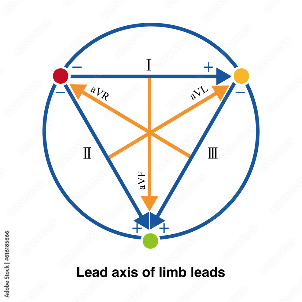 The lead axis of a standard limb lead is the three sides of an ...