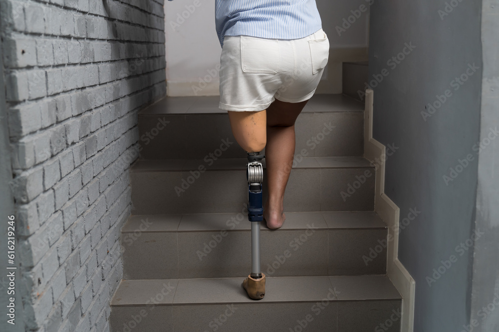 Female with prosthetic leg walking up the stair at home. Woman ...