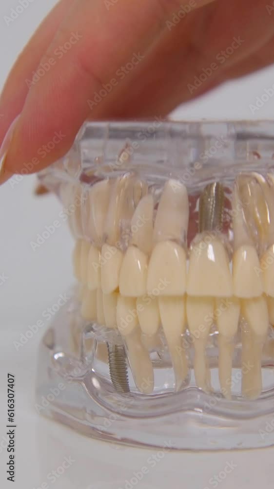 jaw model to demonstrate all dental diseases plastic teeth woman hand ...