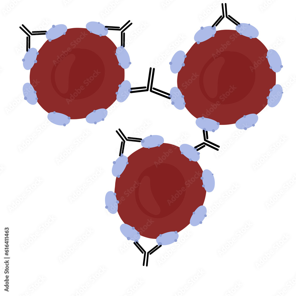 This image explains agglutination in the blood. Agglutination is due to ...