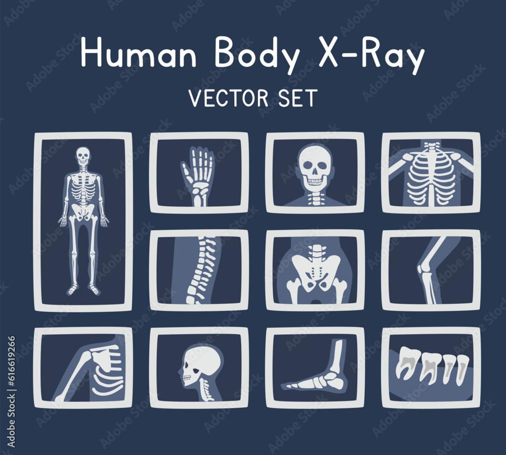 Poster X Ray clipart cartoon style – Wall Art | UkPosters