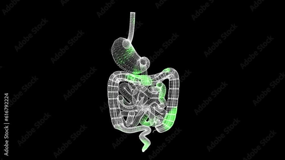 3D Cure of the gastrointestinal tract. The process of treating the ...