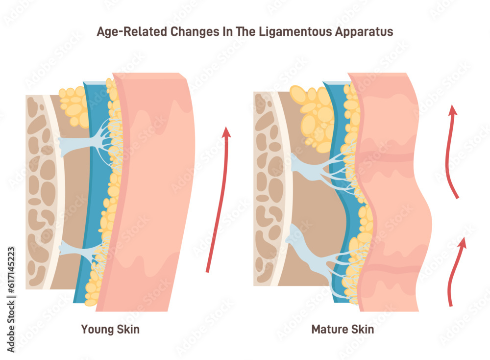 Aging process and face skin ligaments loosening. Close-up skin Stock ...