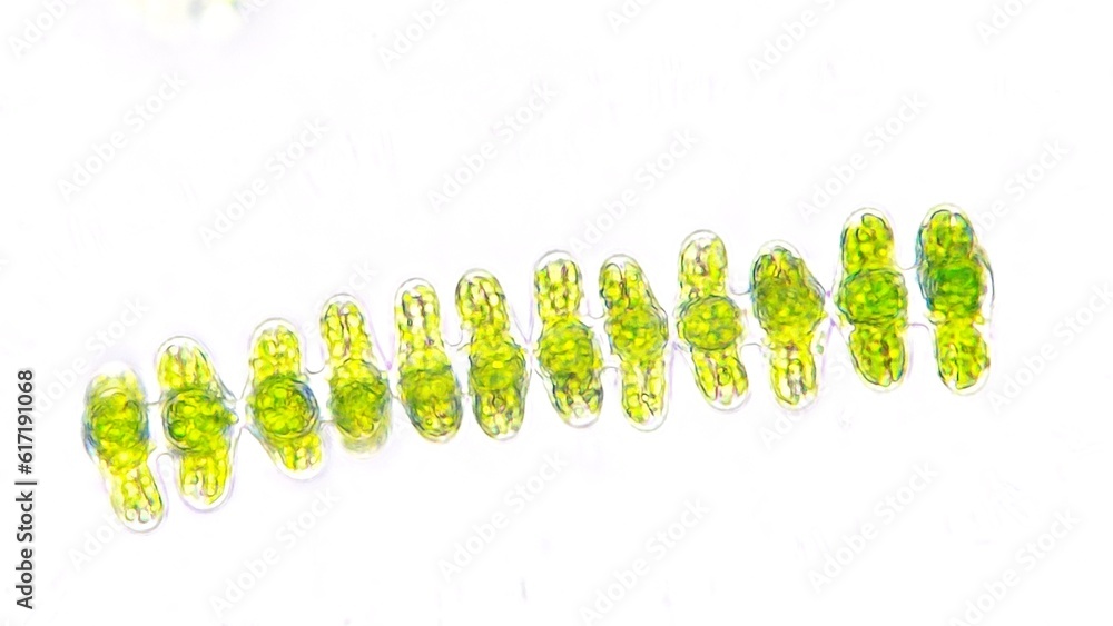 Spondylosium javanicum, a filamentous green algae from desmid group ...