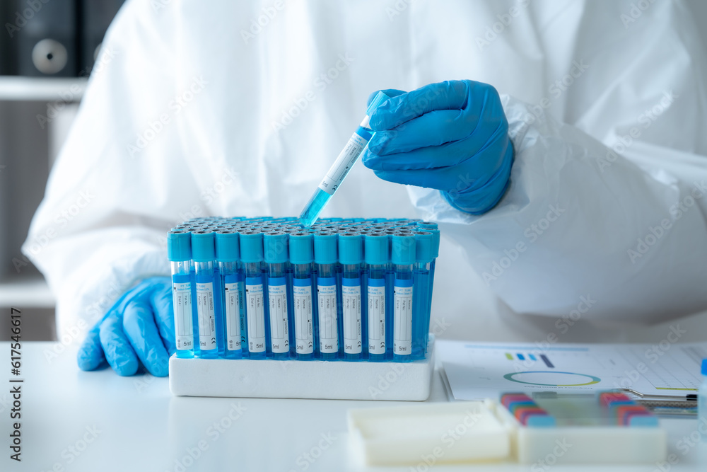 Doctor hand taking a blood sample tube from a rack with machines of ...