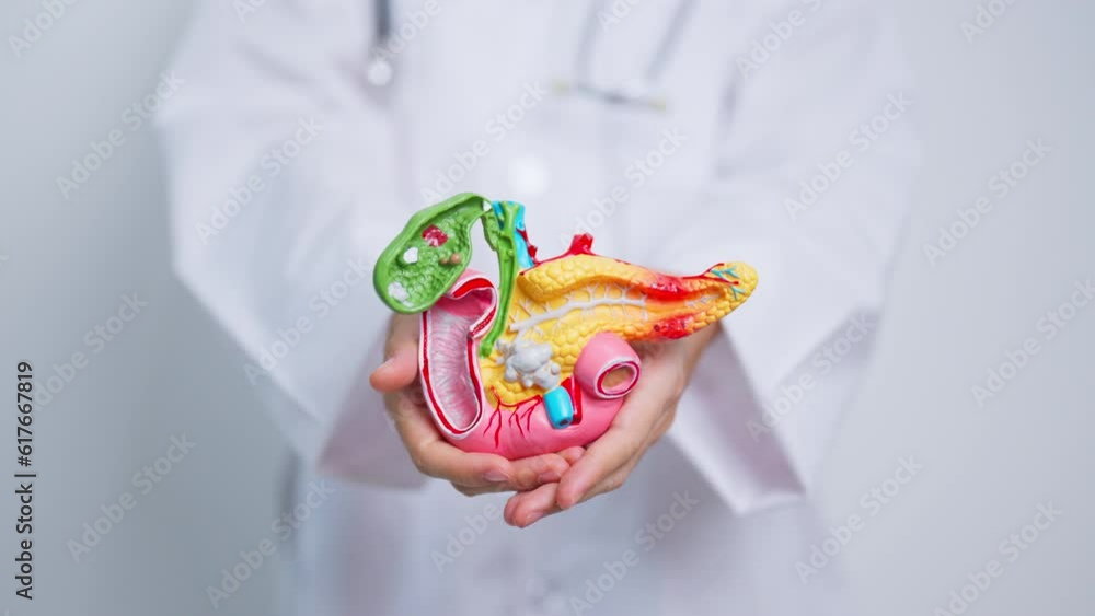 Vidéo Stock Doctor with human Pancreatitis anatomy model with Pancreas ...