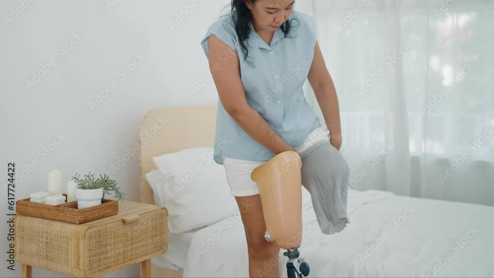 Asian woman amputee wearing leg prosthesis equipment after wake up ...