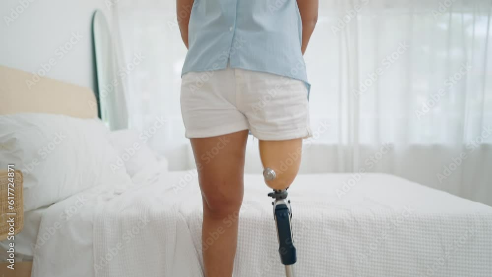 Portrait of happy asian woman amputee in leg prosthesis equipment ...