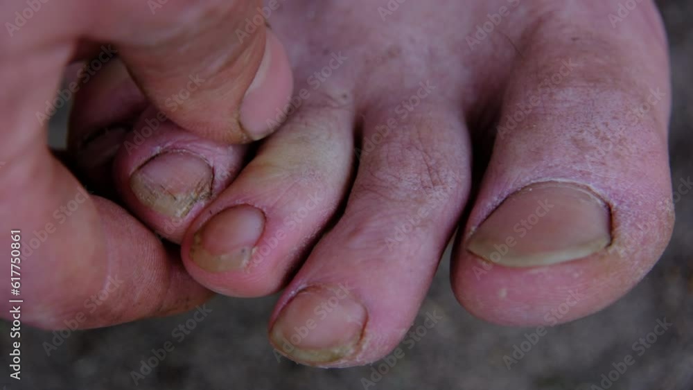 Extreme close up while checking dirty barefoot and toes with nasty ...