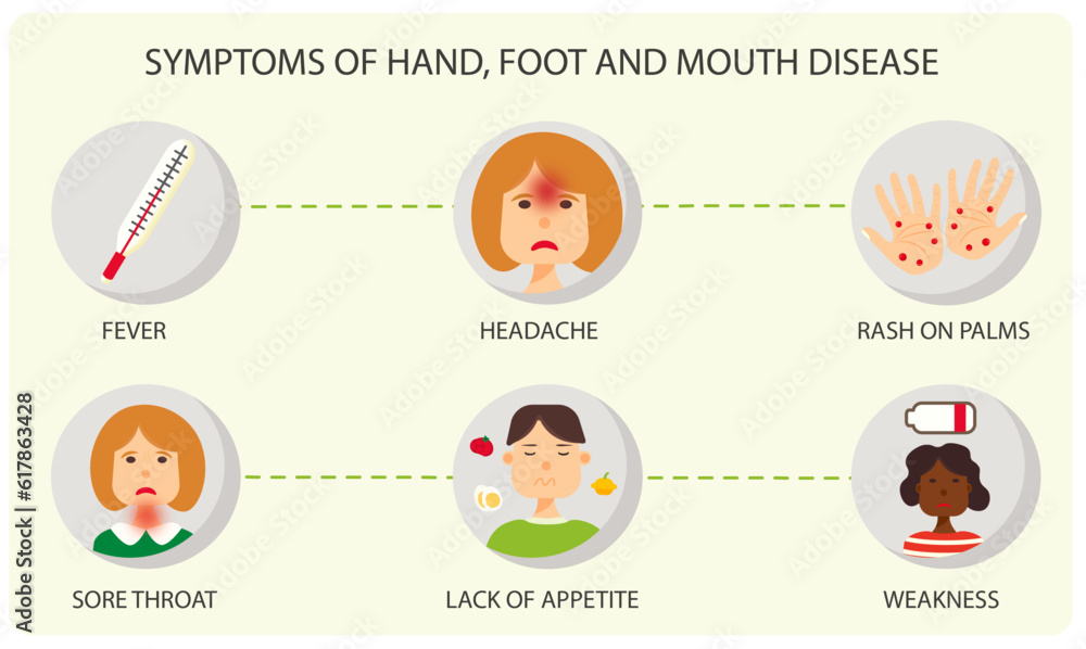 Hand, foot, and mouth disease (HFMD) symptoms fever headache sore ...