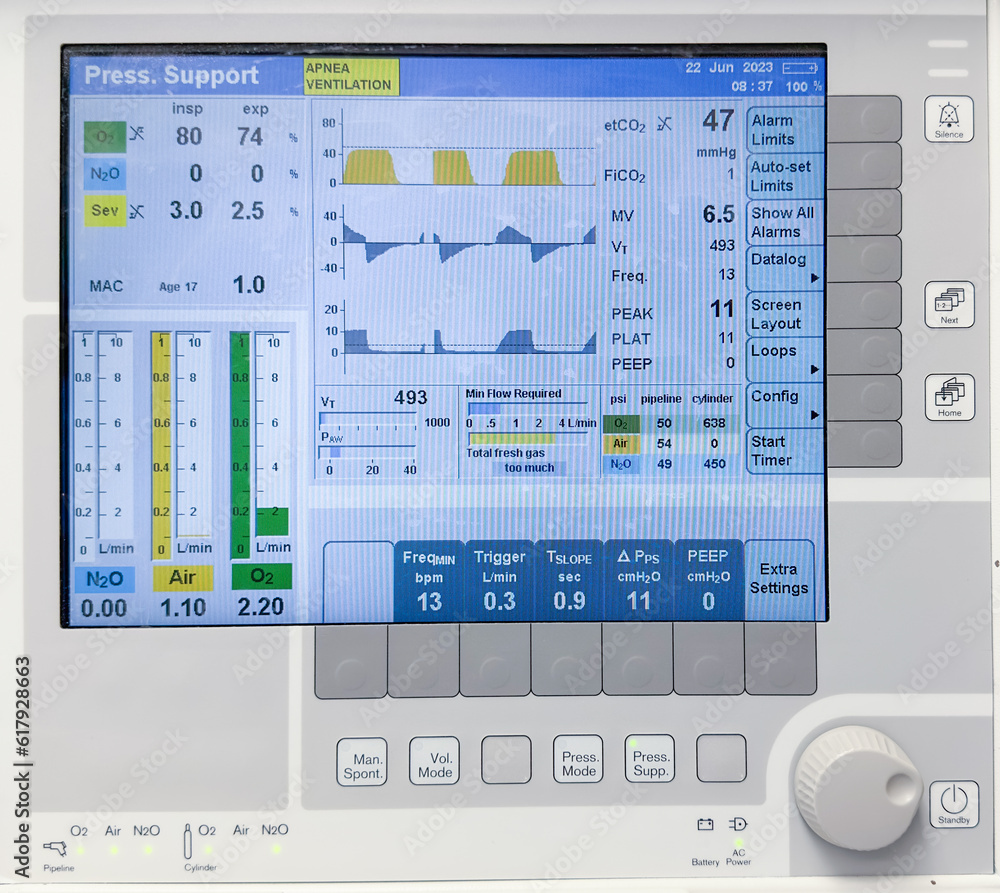 Medical vital signs monitor displaying critical health metrics - blood ...