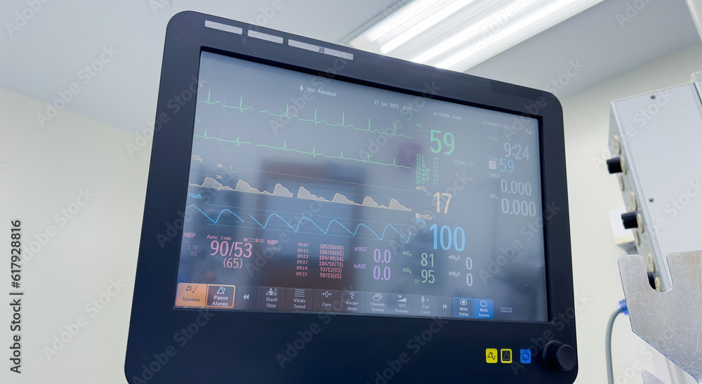 Medical vital signs monitor displaying critical health metrics - blood ...