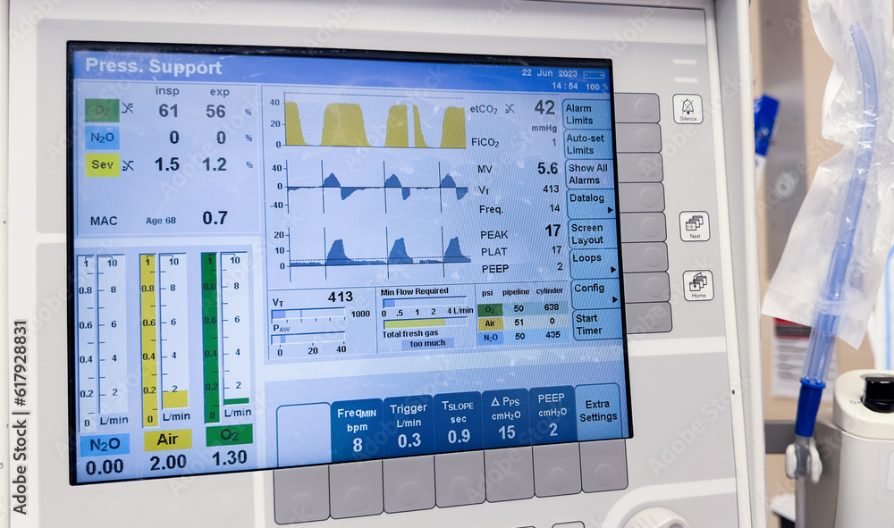 Medical vital signs monitor displaying critical health metrics - blood ...