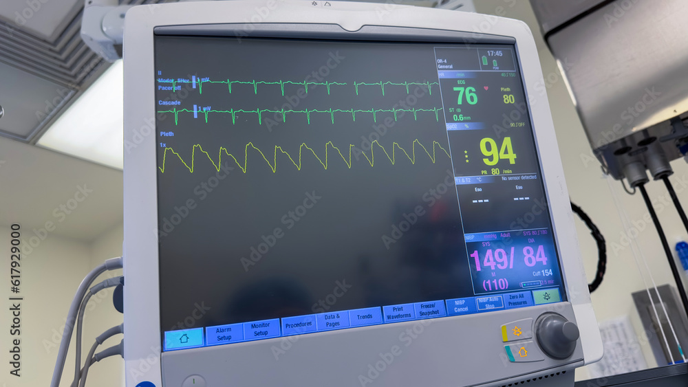 Medical vital signs monitor displaying critical health metrics - blood ...