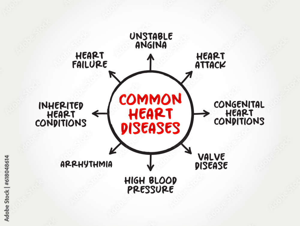 Vetor De Common Heart Diseases Mind Map Text Concept For Presentations And Reports Do Stock