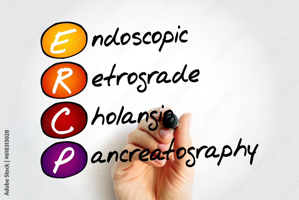 ERCP Endoscopic Retrograde CholangioPancreatography - procedure to ...