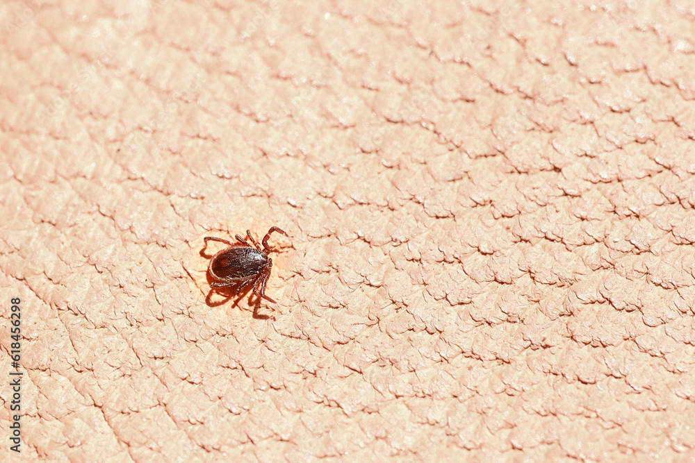 parasitiform tick Ixodidae, blood-sucking parasites on skin ...