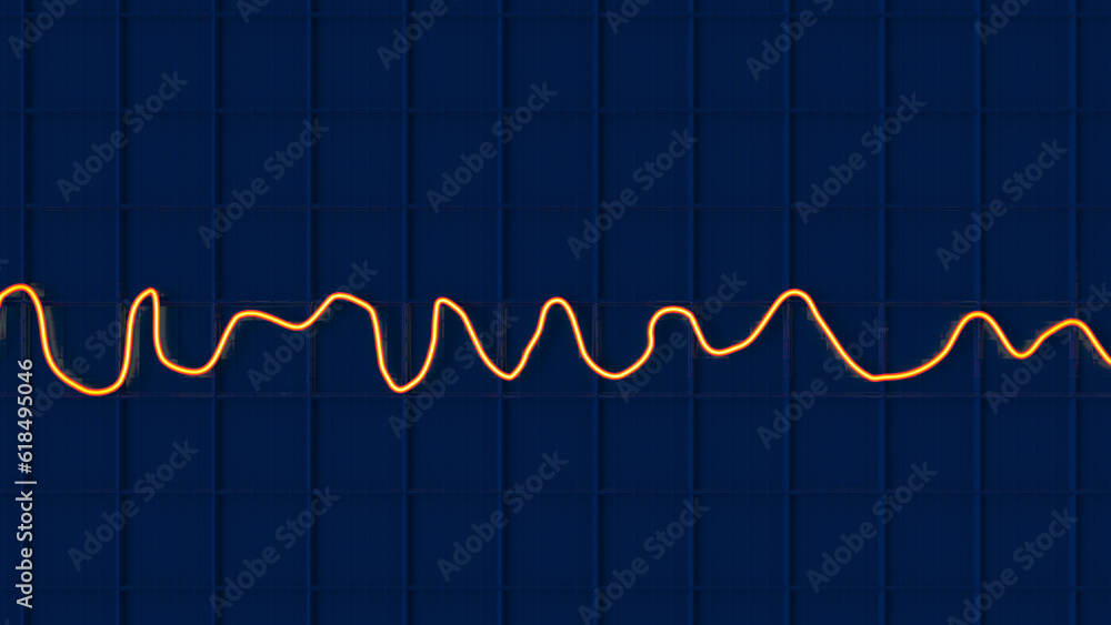 Poster Electrocardiogram ECG displaying ventricular fibrillation rhythm ...