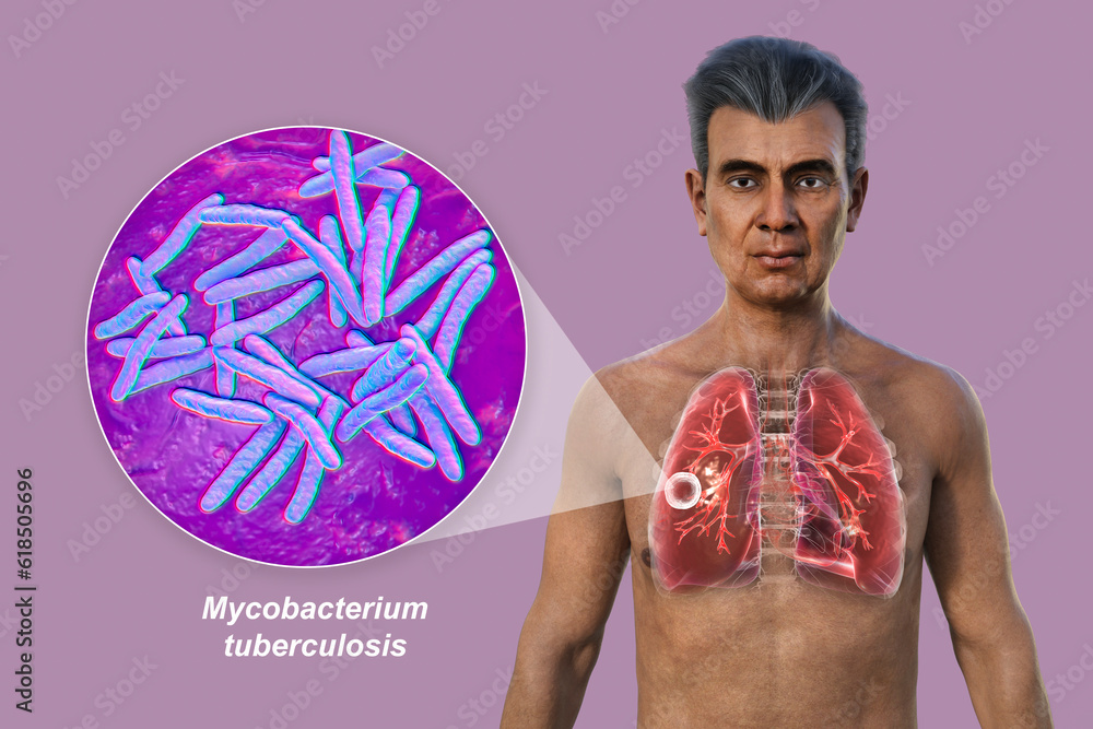 A 3D illustration of the upper half of a man with transparent skin ...