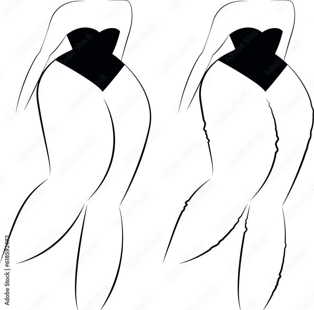 contour silhouette of a lipedema shaped body of a woman. Obesity, plus ...