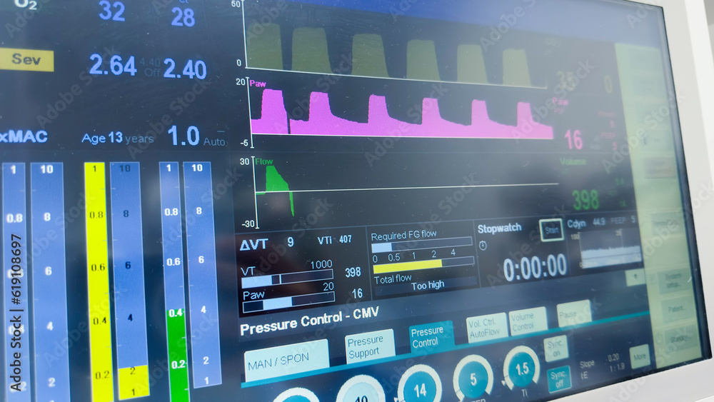 Hospital monitor displaying vital signs: heart rate, blood pressure ...