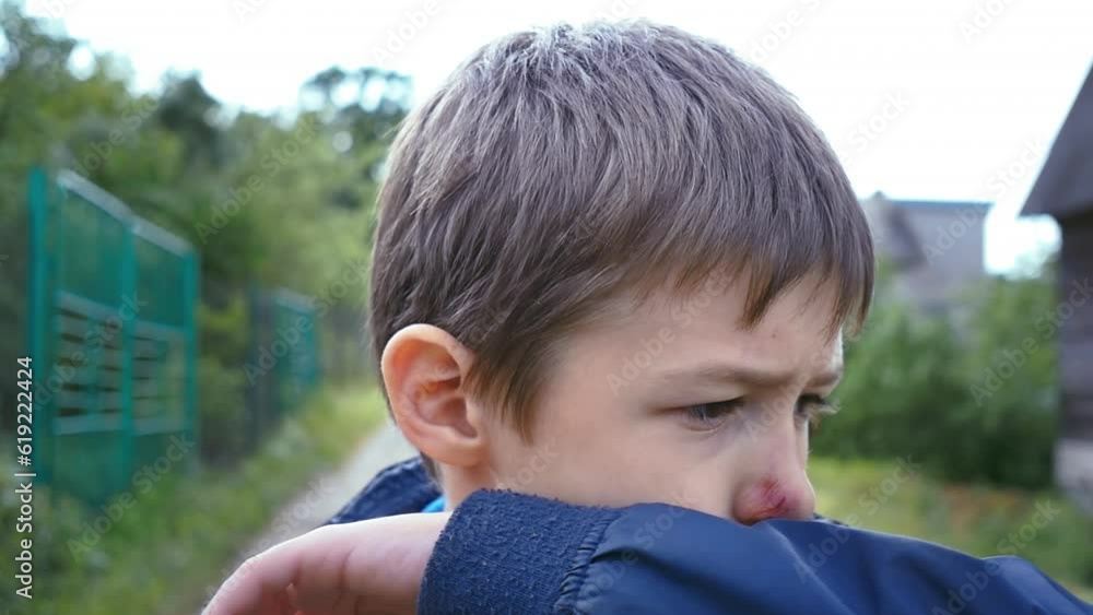 Rising from the Pain: Determined Boy with Wounds on His Face Gathers ...
