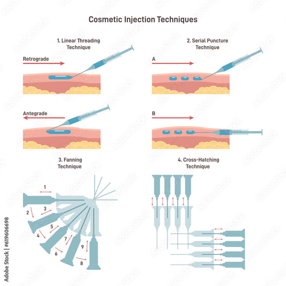 Cosmetic injection technique set. Filler hyaluronic acid facial ...