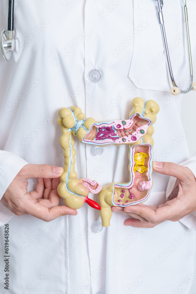 Doctor holding human Colon anatomy model. Colonic disease, Large ...