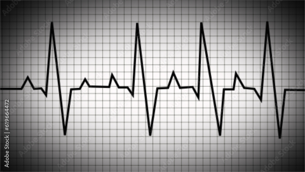 ECG monitoring. Black and white glowing neon heart pulse. Heart beat ...