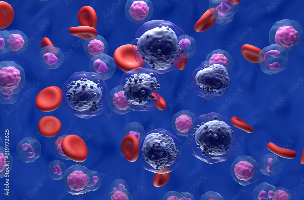 Acute myeloid leukemia (AML) cells in blood flow - isometric view 3d ...