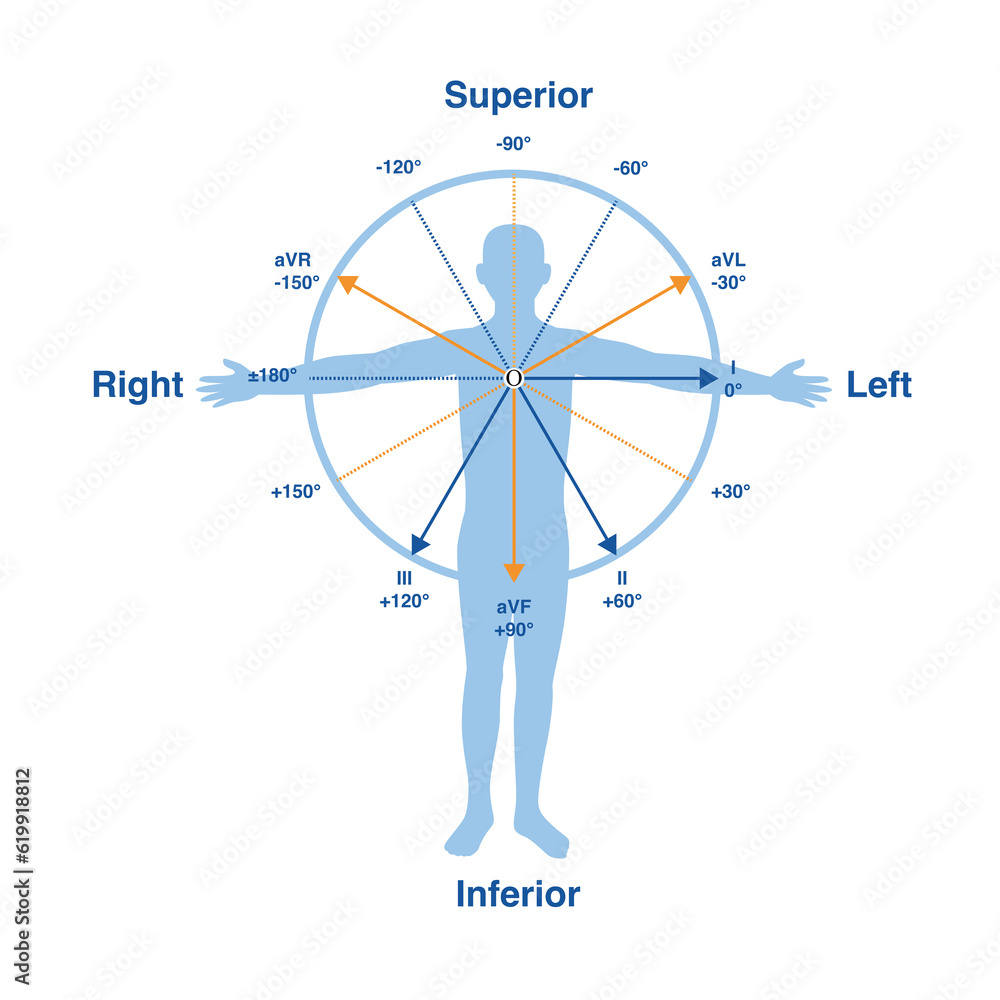 In the frontal lead system, the lead axes of the 6 limb leads form a ...