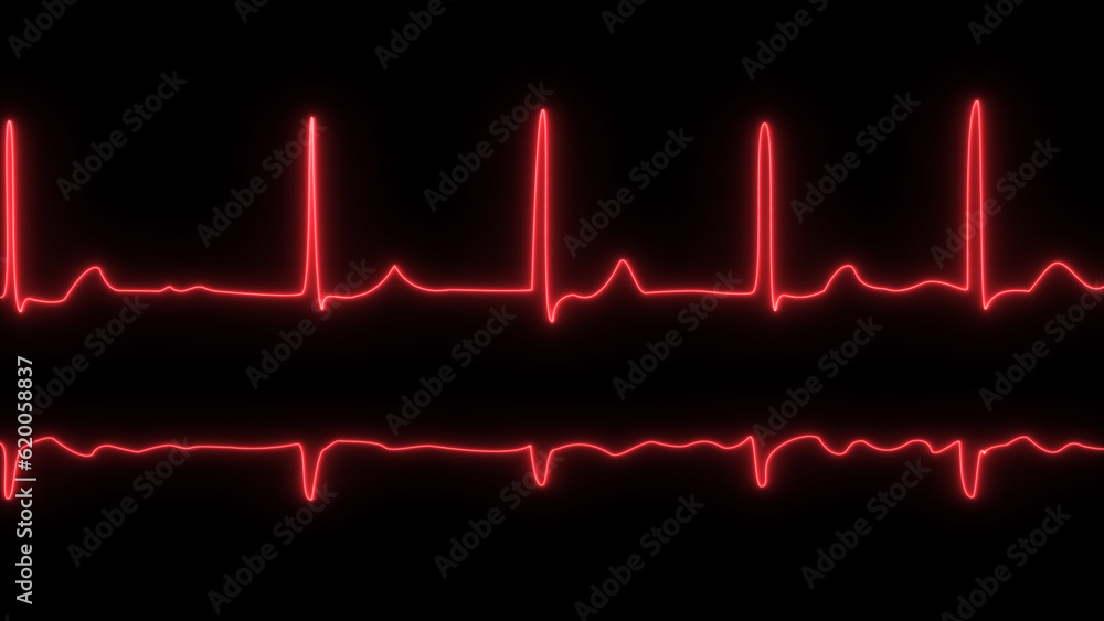 ECG or EKG pulse heartbeat red line symbol on black background ...