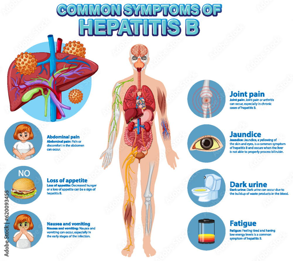 Informative poster of common symptoms Hepatitis B Stock Vector | Adobe ...