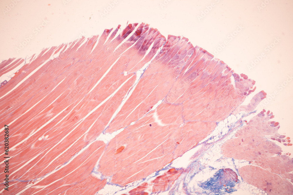 Showing Light micrograph of the Thyroid gland and Thymus gland human ...