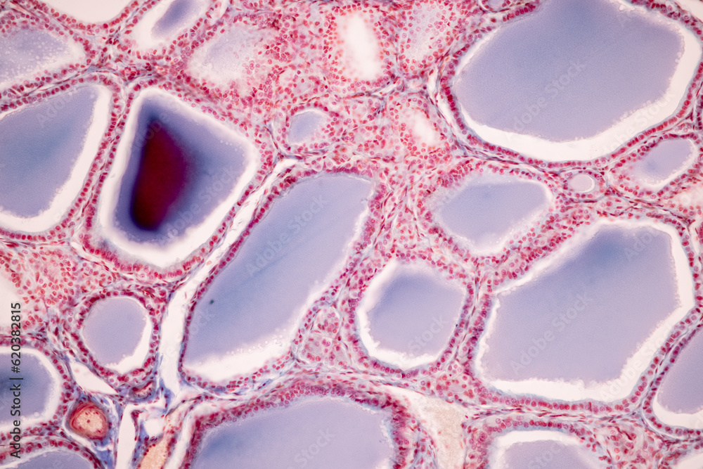 Showing Light micrograph of the Thyroid gland and Thymus gland human ...