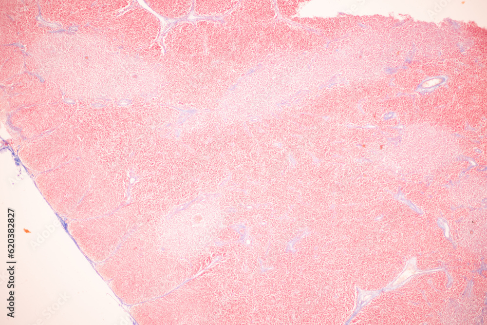 Showing Light micrograph of the Thyroid gland and Thymus gland human ...