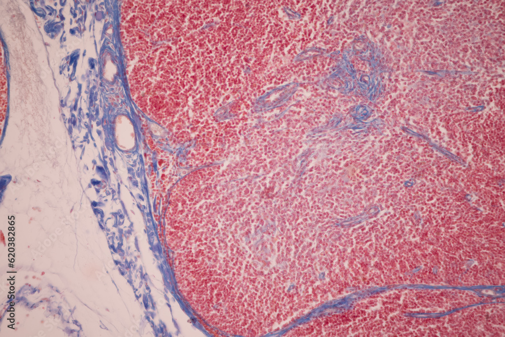 Showing Light micrograph of the Thyroid gland and Thymus gland human ...