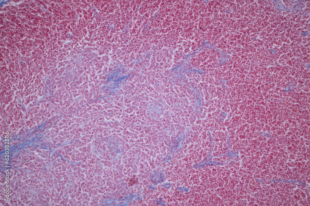 Showing Light micrograph of the Thyroid gland and Thymus gland human ...