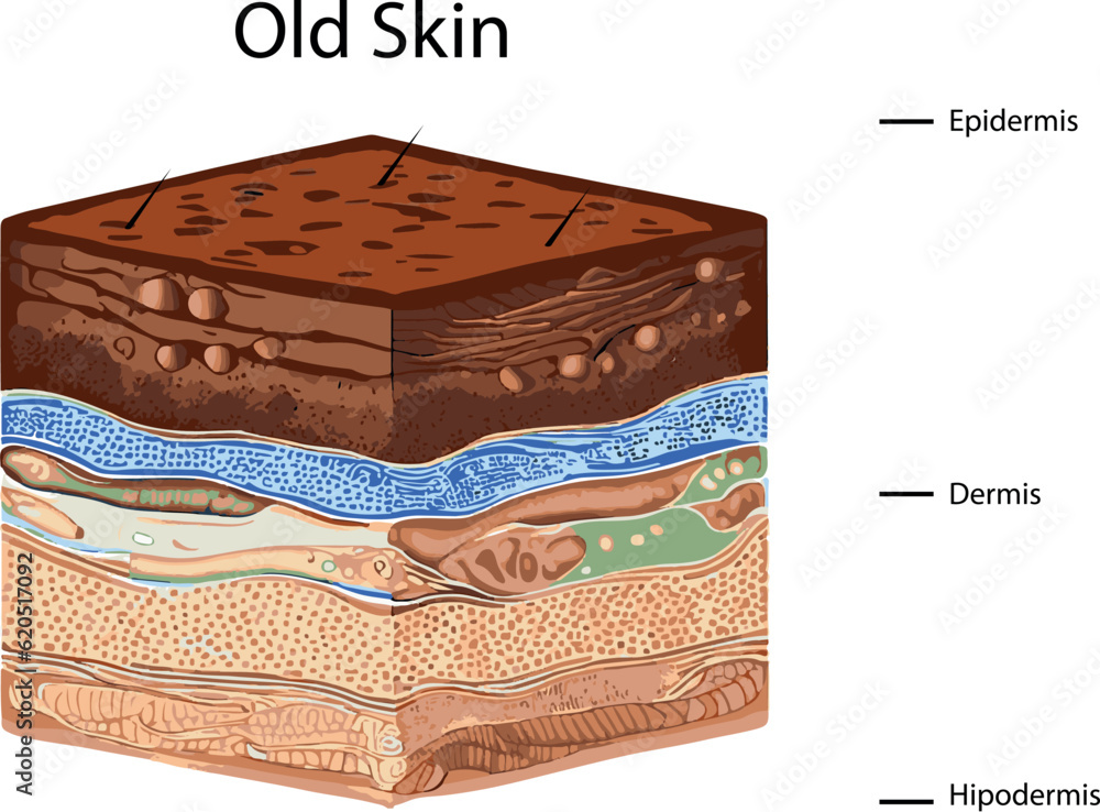 Diagram showing the structure of an old skin on a white background ...