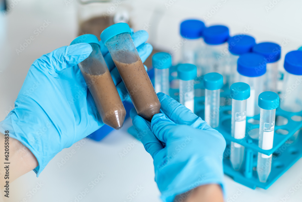 Scientist carefully handles fecal transplant liquid in test tubes ...