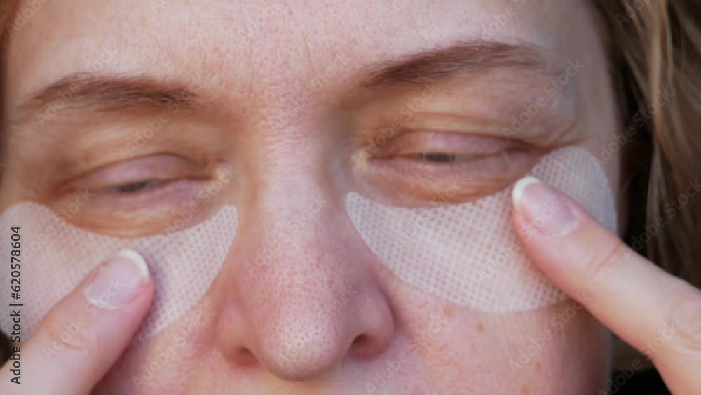 middle aged female's eye with drooping eyelid with patch for eyes ...