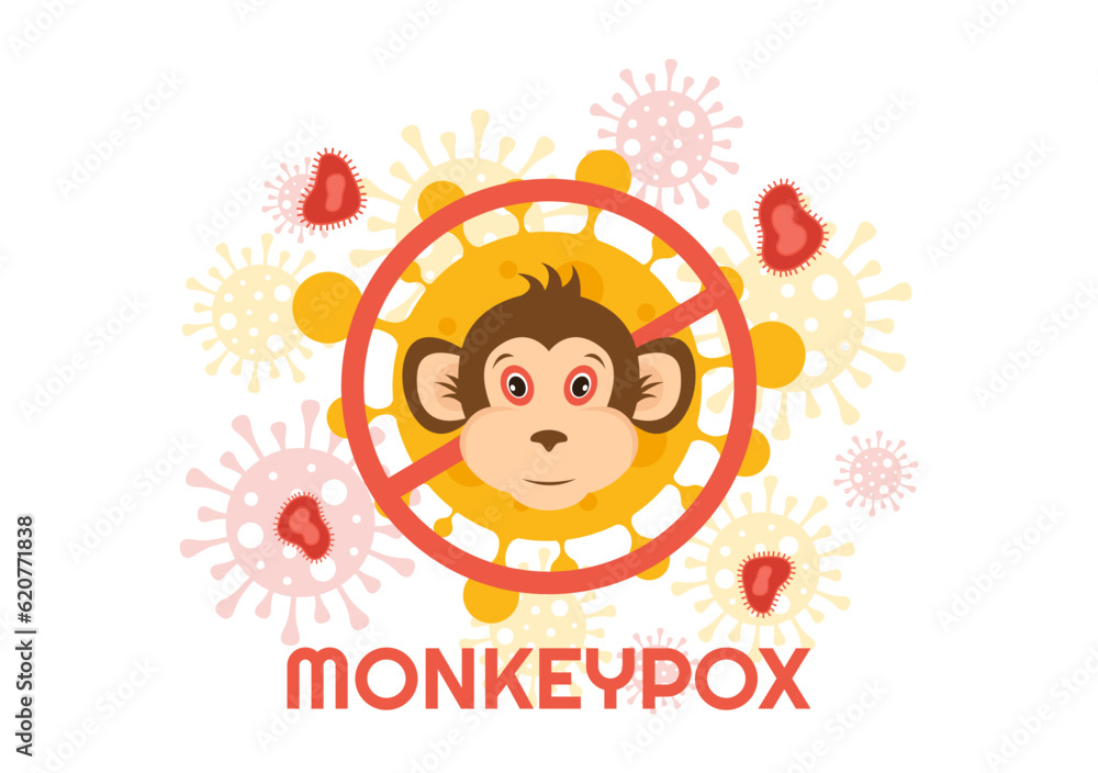 Monkey Pox Outbreak Vector Illustration of Virus Symptoms in Humans ...