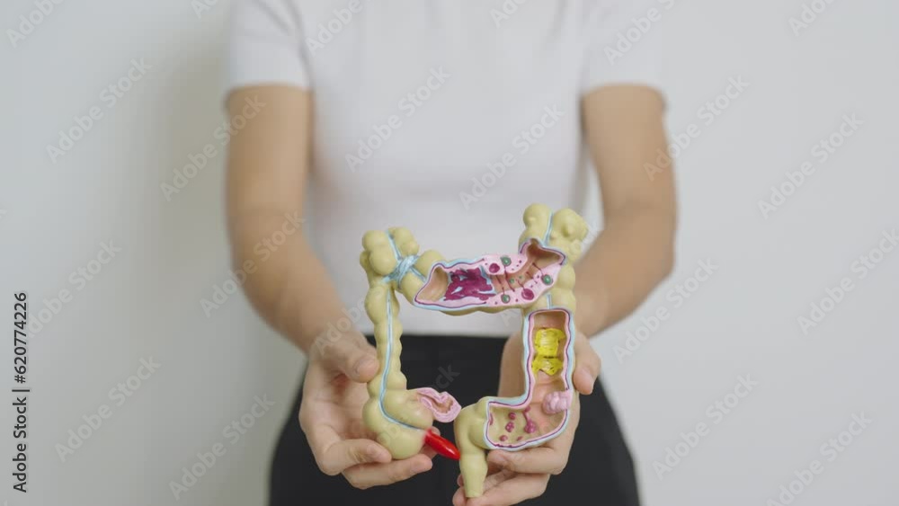 Woman holding human Colon anatomy model. Colonic disease, Large ...