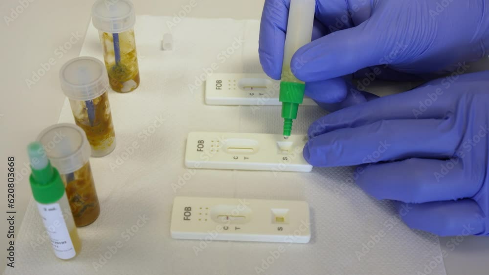 Twisting off the test tube to drip human stool sample onto rapid test ...