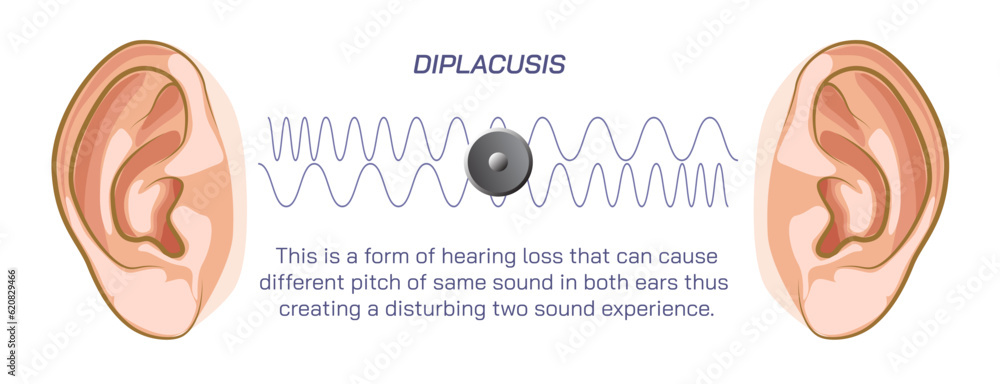 Difference between two ears, double hearing, density or pressure of ...