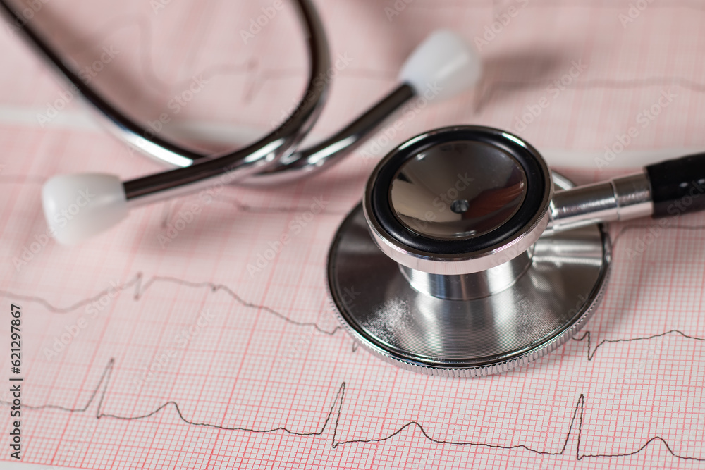 Stethoscope on electrocardiogram ECG chart paper. ECG heart chart scan ...